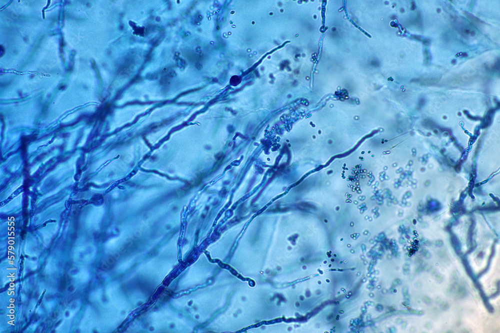 Microscope of black fungus spore strain with Lactophenol cotton blue ...
