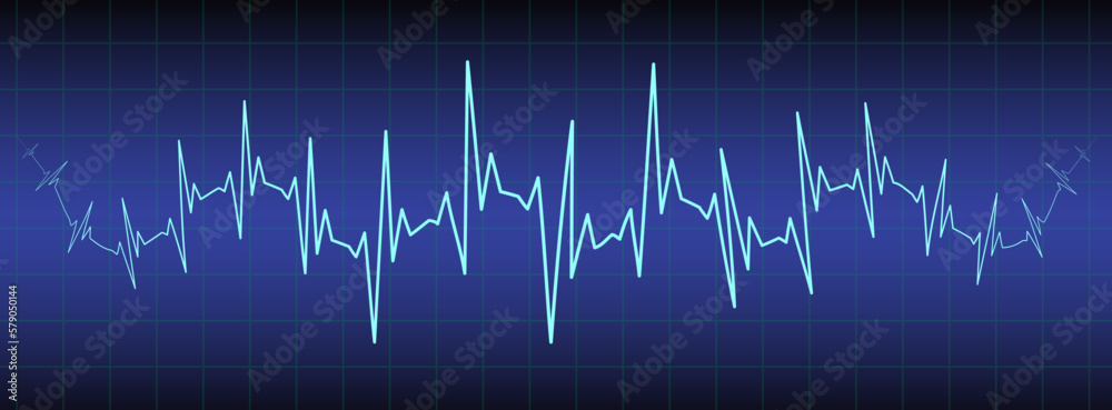 Poster Editable stroke high heart rate ascending, descending, blue EKG ...