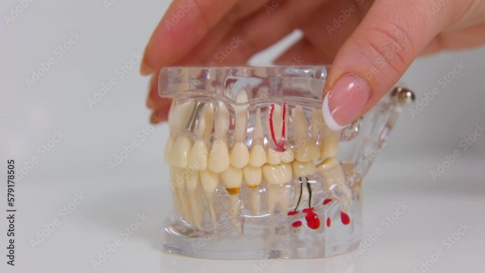Stockvideo jaw model to demonstrate all dental diseases plastic teeth ...