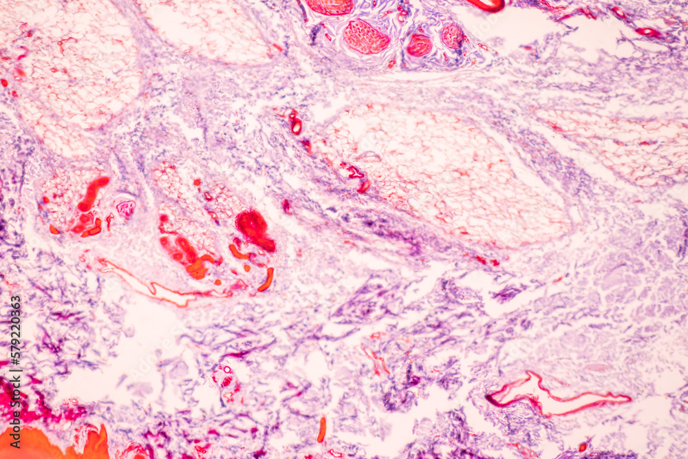 Characteristics Tissue of Skin from finger Human and Nail development ...