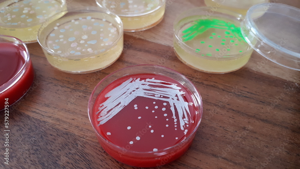 Agar petri dish with microbial streaks and colonies; blood agar and ...