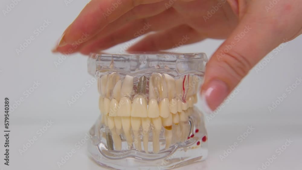 jaw model to demonstrate all dental diseases plastic teeth woman hand ...