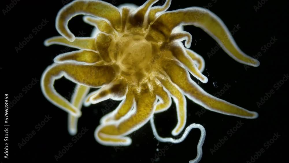 Young Actiniaria under a microscope, class Anthozoa, Hexacorallia ...
