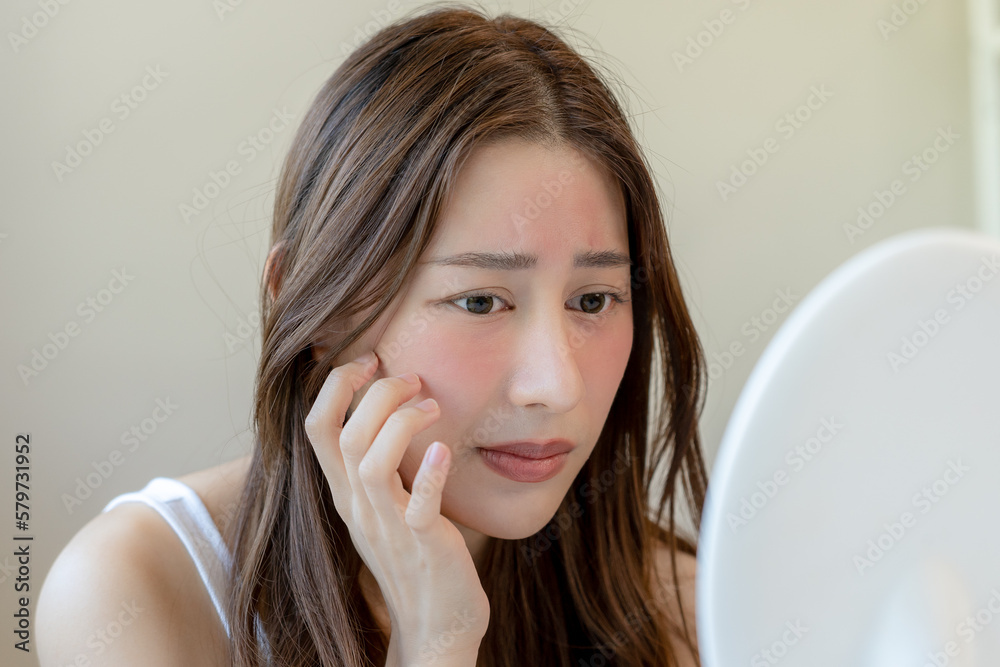 Woman worried about face Dermatology, rosacea dermatitis, allergic ...