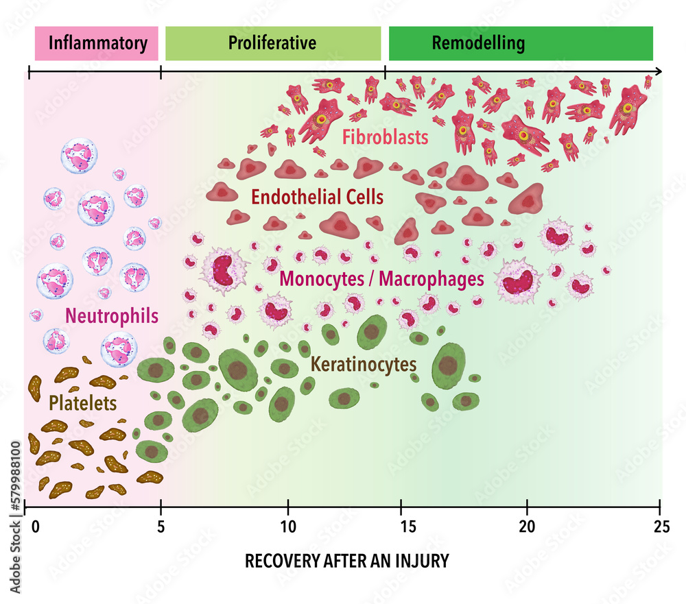 RECOVERY AFTER AN INJURY Stages of the wound healing process Stock ...