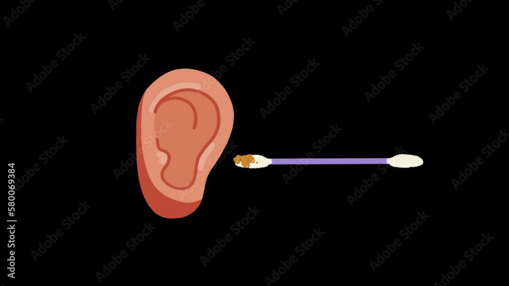 Using a Q tip to remove an excessive ear wax buildup, 4k animation with ...