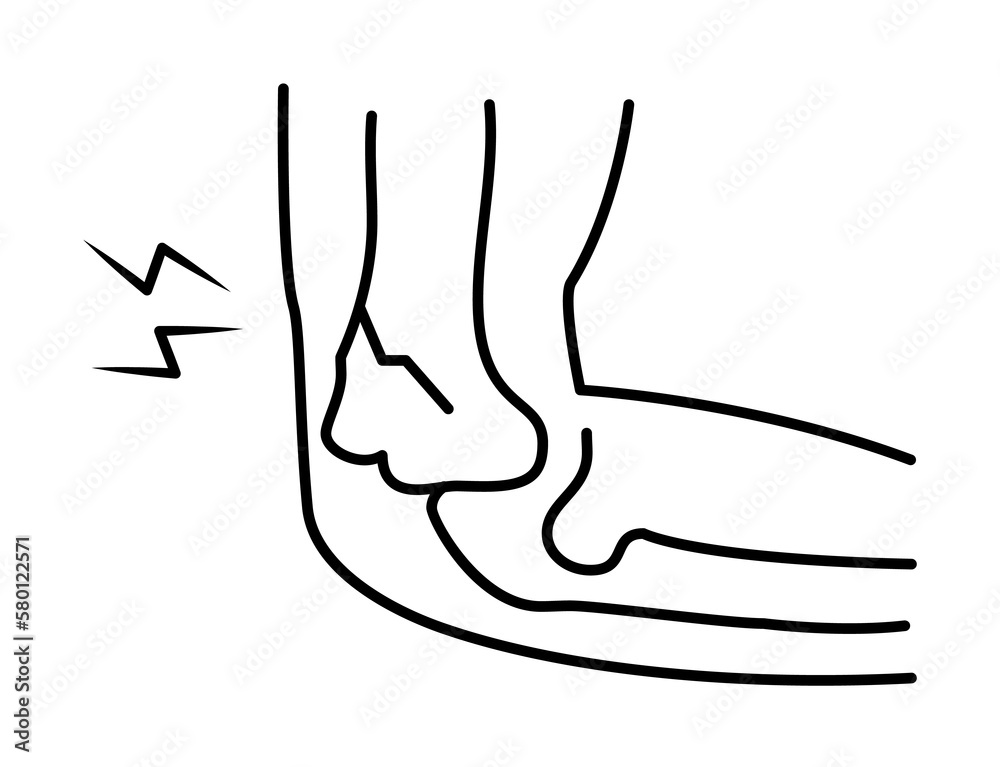 Elbow bone injury icon. Simple line, outline of human skeleton icons ...