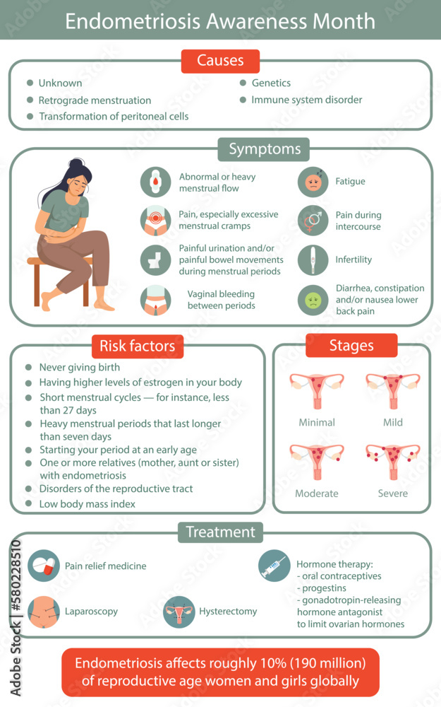 Endometriosis infographic. Detailed vector Infographic. Women Health ...