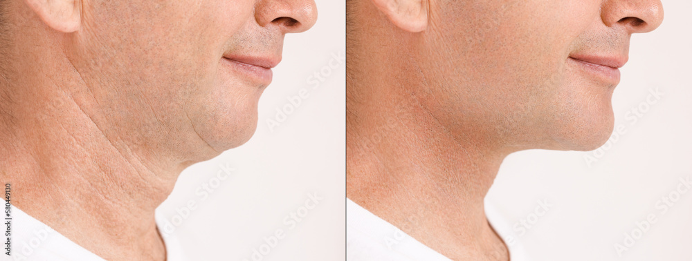 A close portrait of an aged woman before and after the facial ...