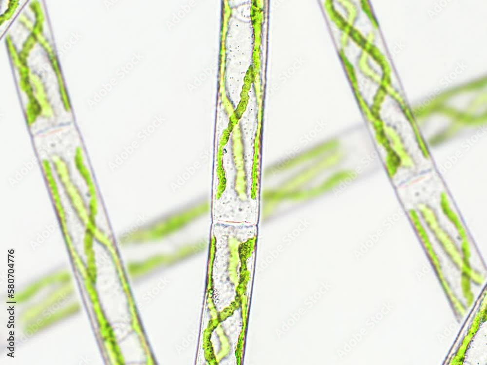 Chlorophyta Spirogyra
