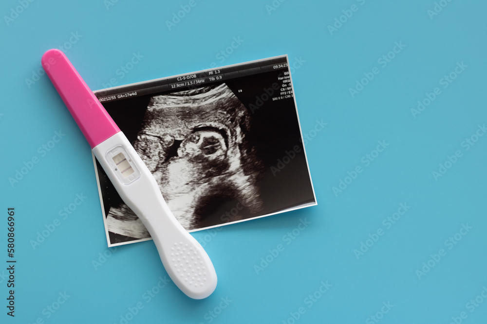 Pregnancy test and baby ultrasound photo scan photo on blue background ...