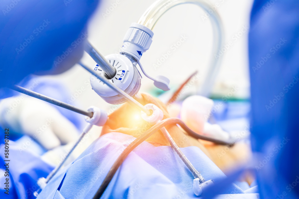 Surgeon or doctor did laparoscopy or endoscopy on minimal invasive ...
