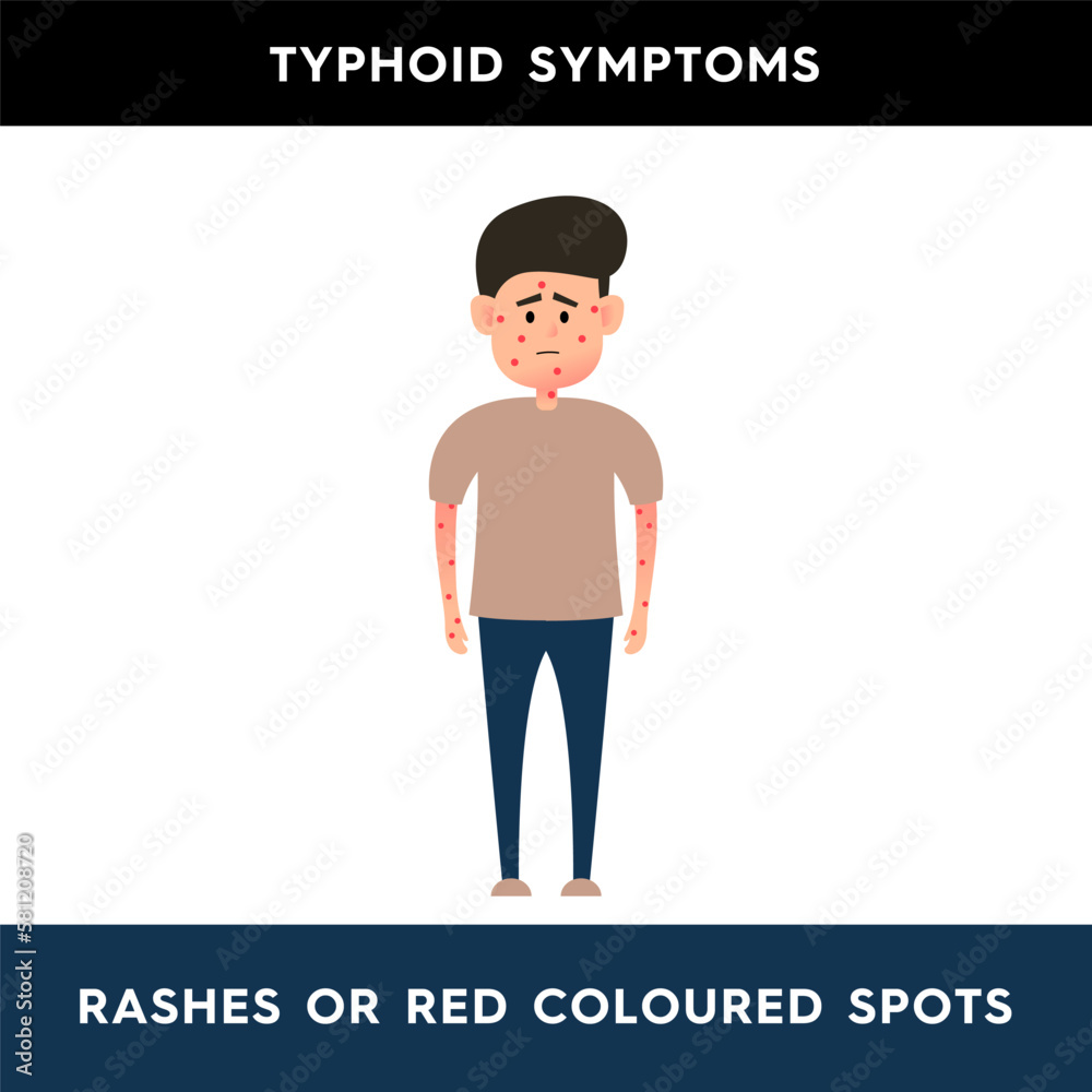 Vector illustration of a man who developed a red rash all over his body ...
