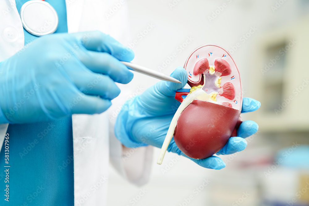 Chronic kidney disease, doctor holding model for treatment urinary ...