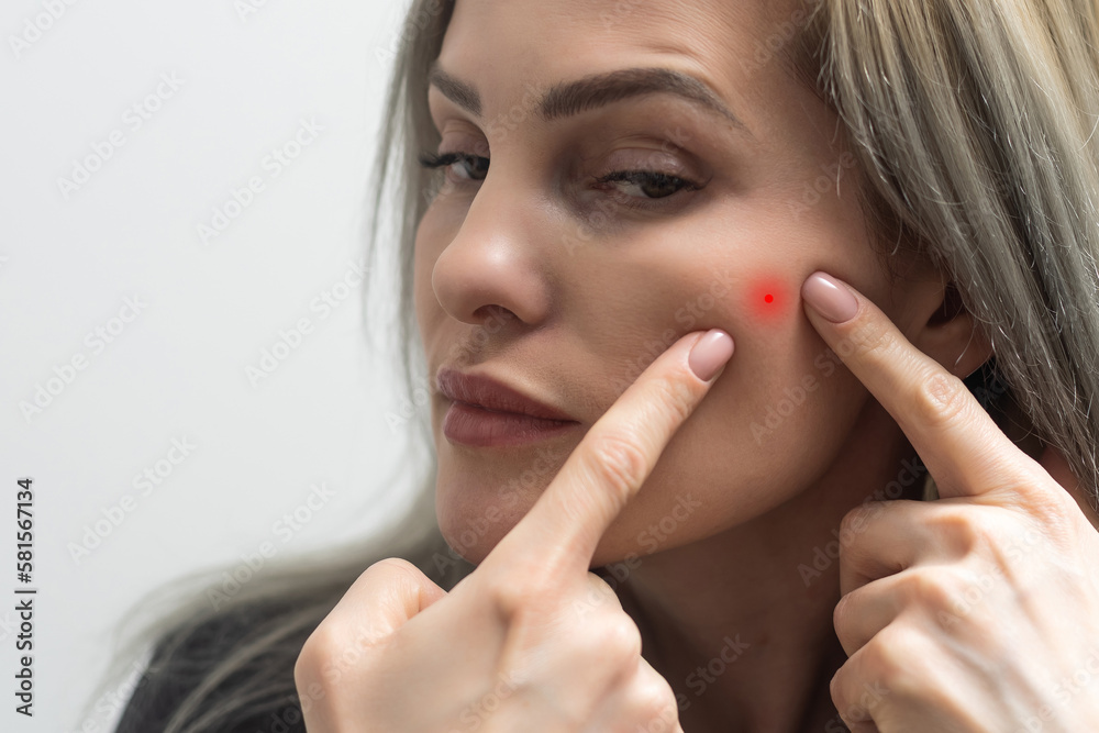 Foto de Dermatology, scratch asian young woman looking at mirror ...