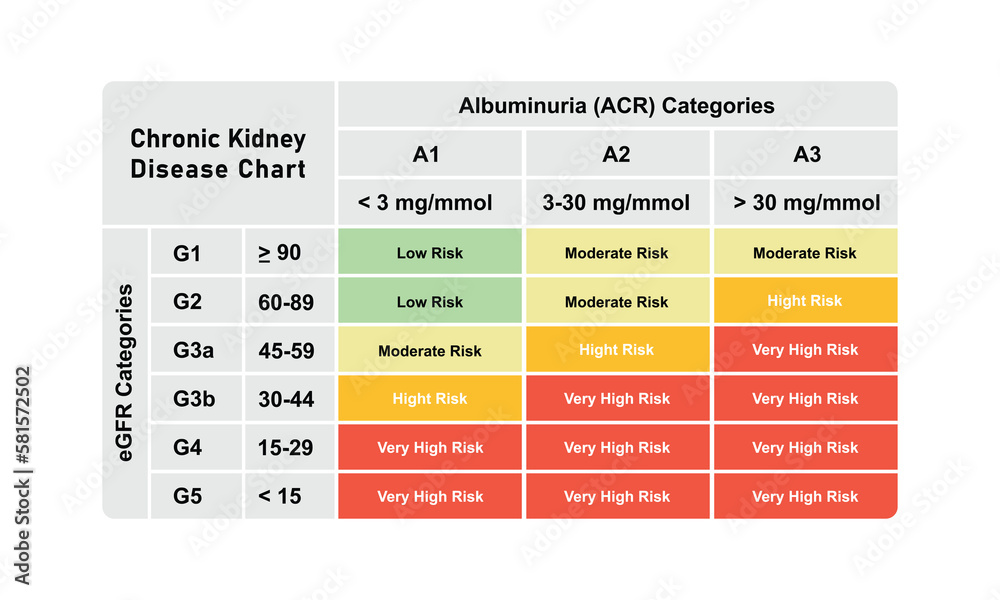 Vetor de Scientific Designing of Chronic Kidney Disease (CKD) Stages ... Vetor de Scientific Designing of Chronic Kidney Disease (CKD) Stages ...