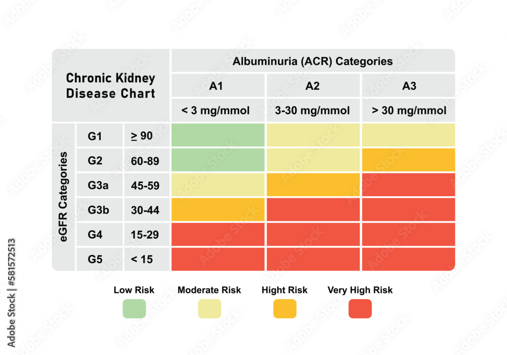 Scientific Designing of Chronic Kidney Disease (CKD) Stages. Vector ...