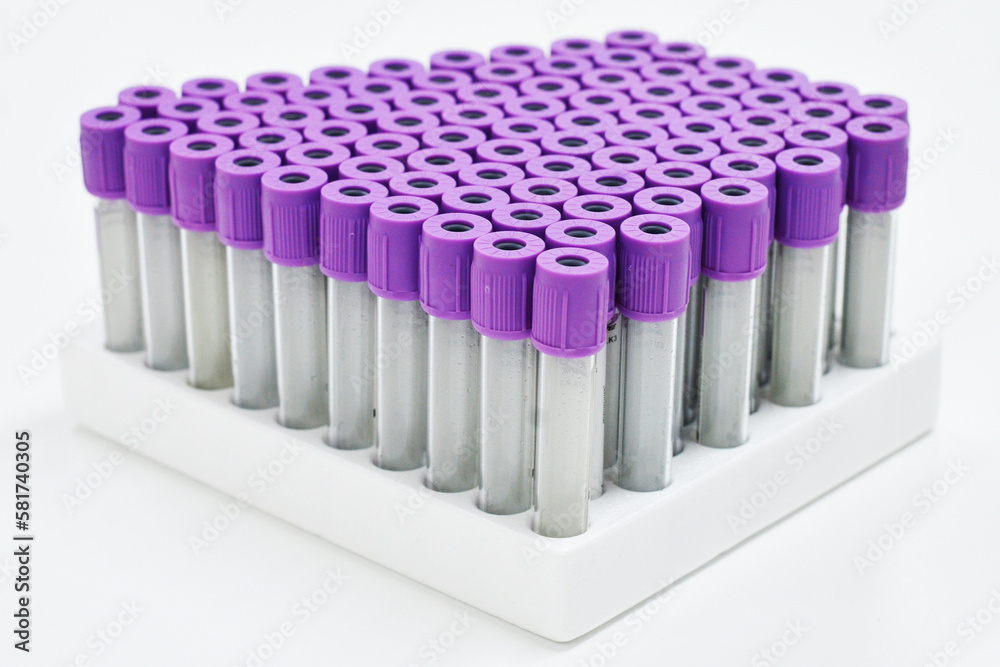 Purple vacuum blood collection tube with EDTA as anticoagulant for ...