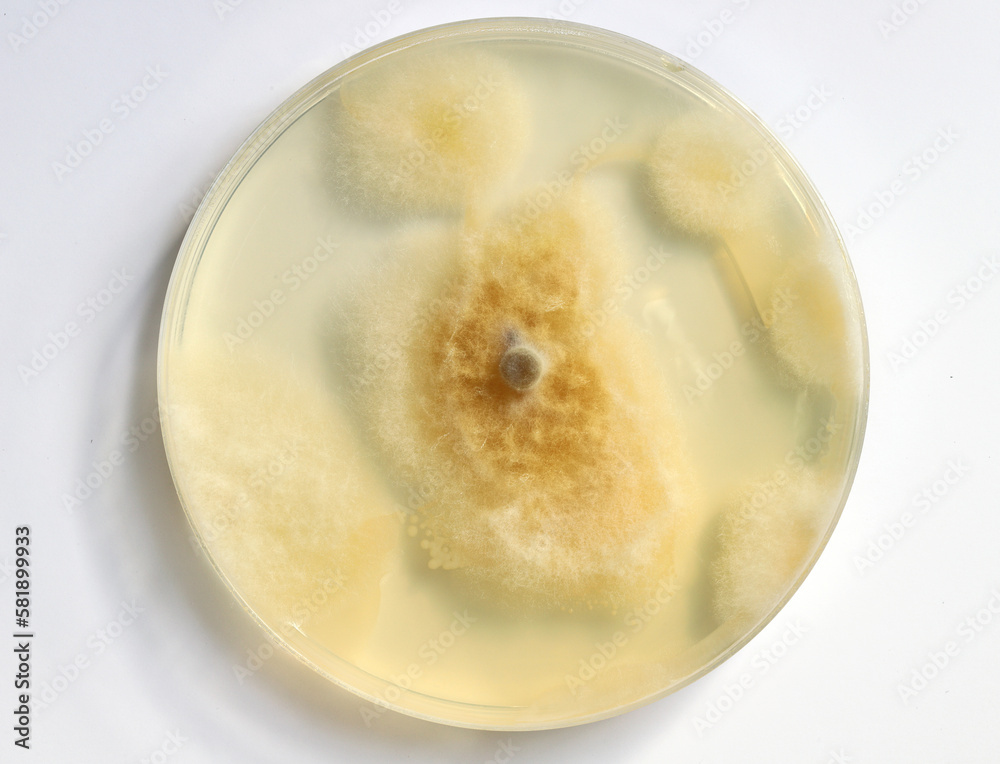 Foto de growth of microorganisms in a Petri dish, Bacteria, yeast and ...