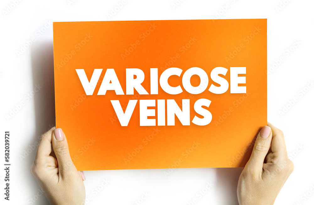 Varicose Veins - swollen and enlarged veins that usually occur on the ...