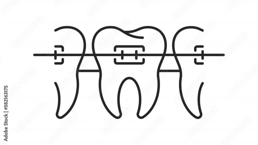 Animated braces linear icon. Orthodontic procedure. Dentistry. Teeth ...