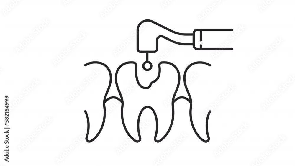 Vidéo Stock Animated tooth decay linear icon. Dental cavity treatment ...