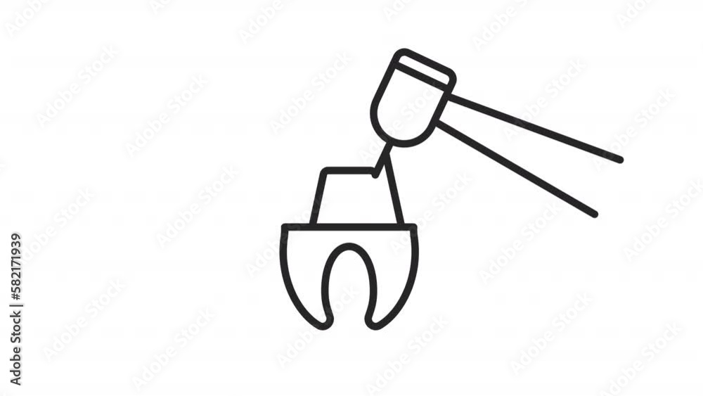 Animated dental crown linear icon. Tooth restoration. Dental procedure ...