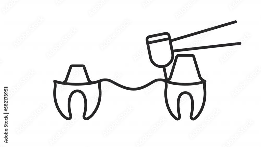 Animated dental bridge linear icon. Artificial teeth. Replace missing ...