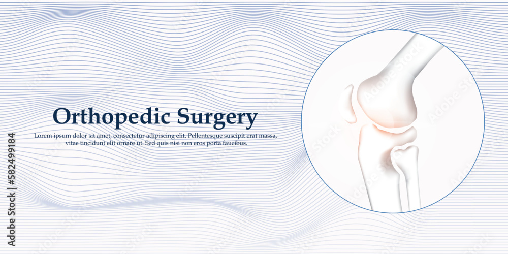 This medical-themed vector of orthopedic treatment for traumatology of ...