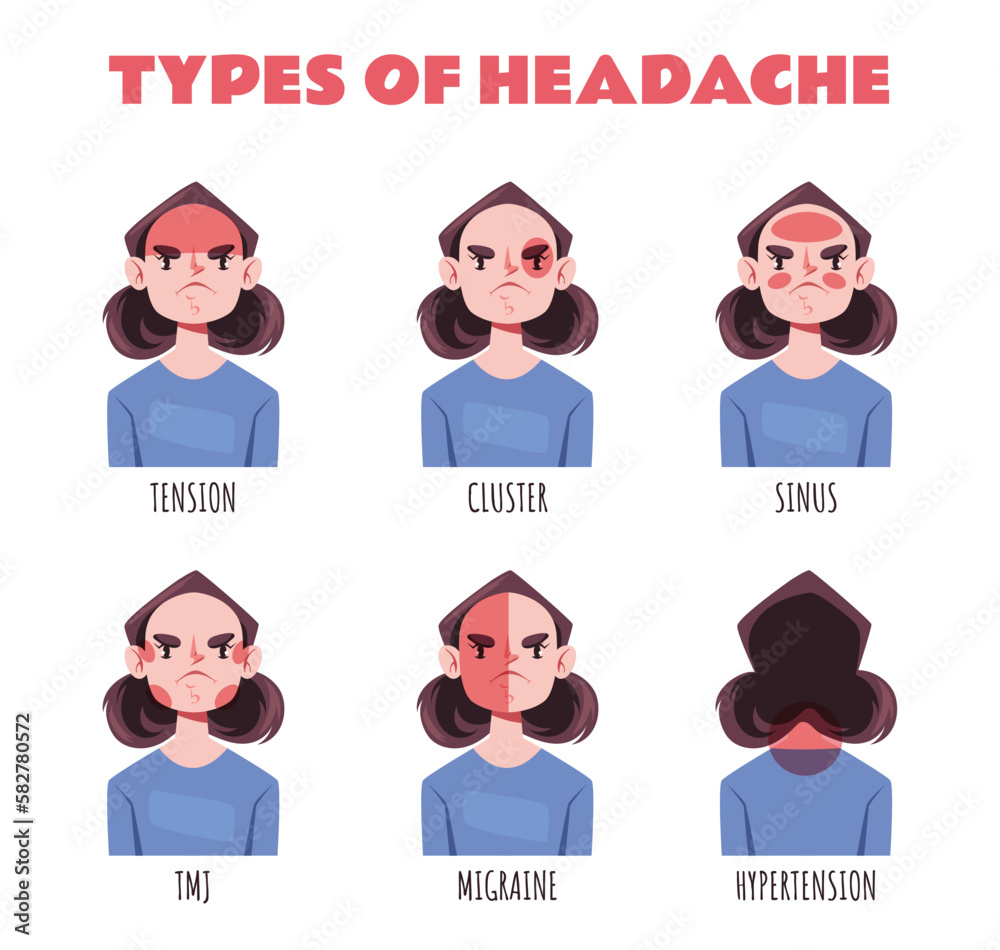 Headache type pain sinus chronic head migraine symptoms isolated set ...