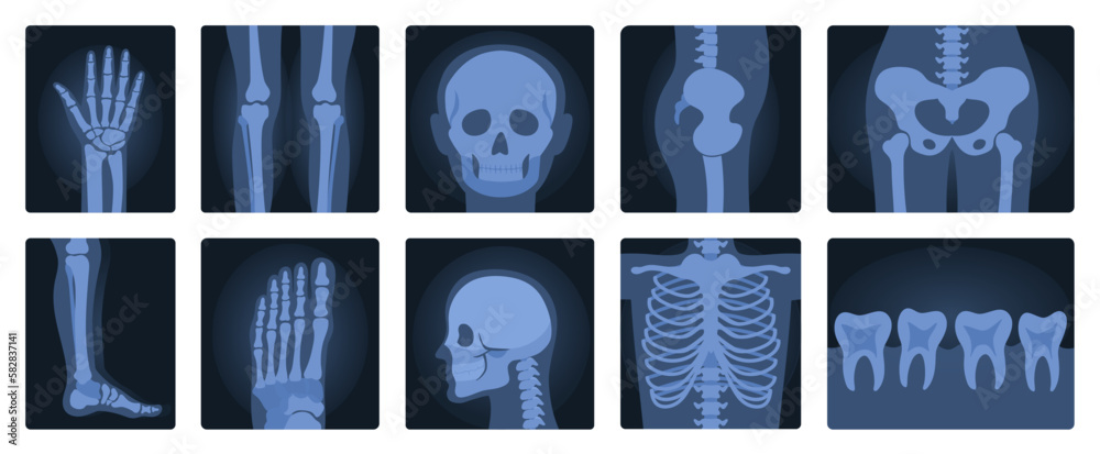 Xrays films of human body set, radiography and anatomy vector illustration. Cartoon isolated ...