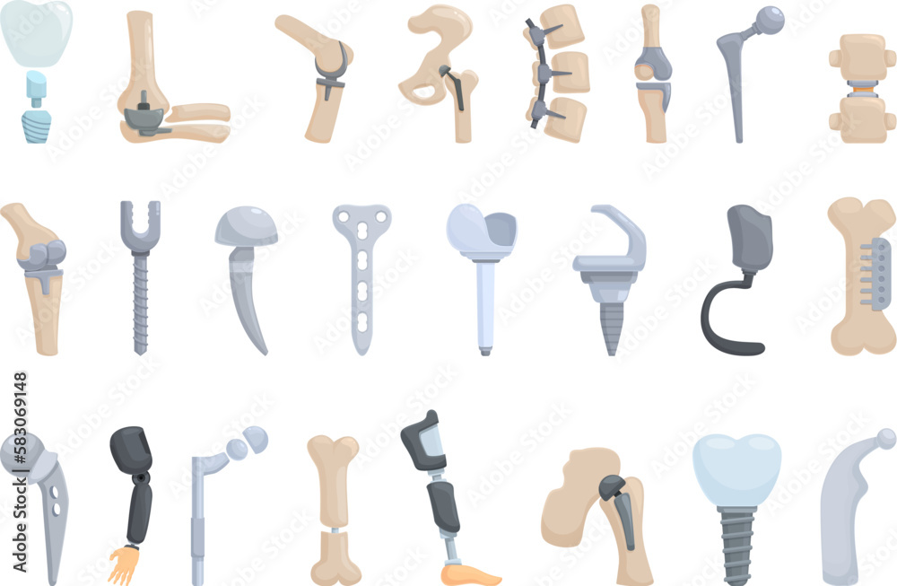 Orthopedic implants icons set cartoon vector. Hip replacement. Surgery ...