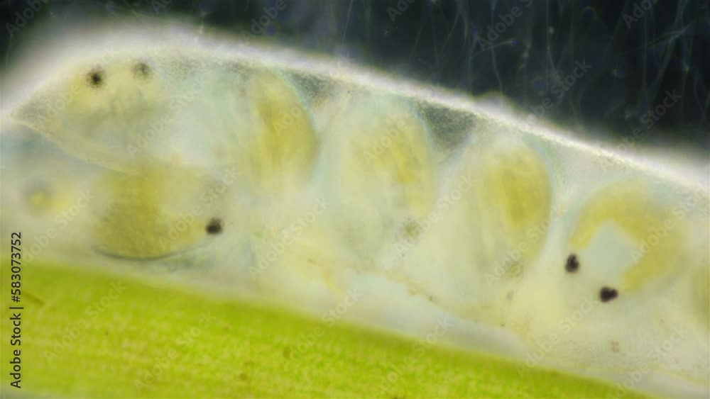 Cocoon with Eggs and Larvae water mites Hydrachnidia under a microscope ...