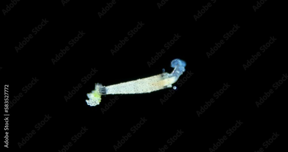 Rotifera family Flosculariidae under a microscope, possibly Limnias sp ...