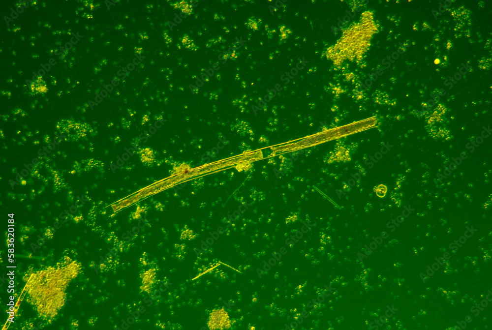 Microscopic view of various species of planktonic freshwater algae ...
