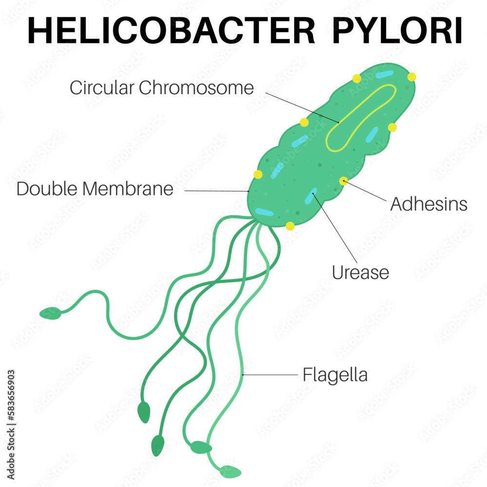 Vetor de Helicobacter pylori (H. pylori) is bacteria infect your ...