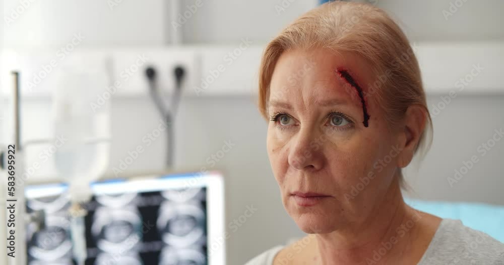 Portrait of sad woman patient with bloody wound on forehead in hospital ...