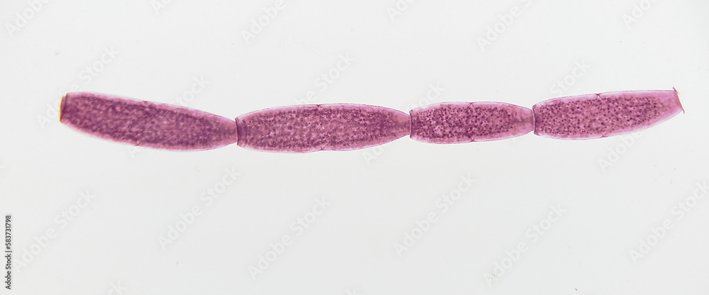 dipylidium caninum (gravid proglottids), parasites, cestodes Stock ...