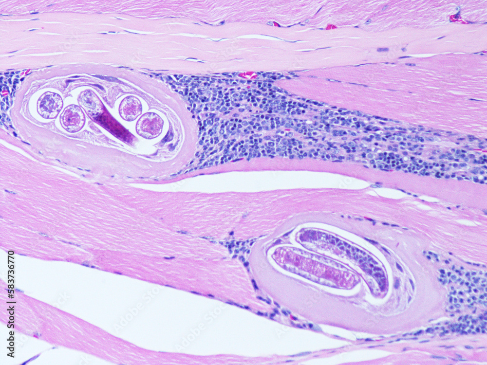 Trichinella spiralis, parasite, encyst larva, worm, nematode Stock ...