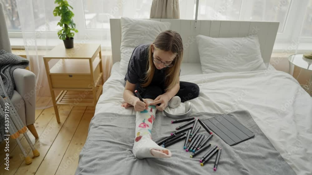 Teenager girl paints on cast leg with felt-tip pens. Young woman draws ...