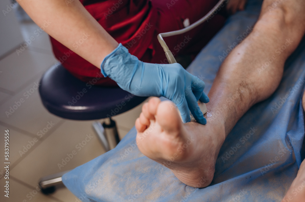 Medical specialist performing doppler ultrasound of the lower limb ...