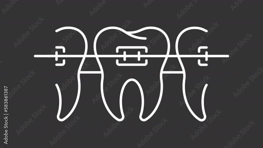 Animated braces white line icon. Orthodontic procedure. Dentistry. Loop ...