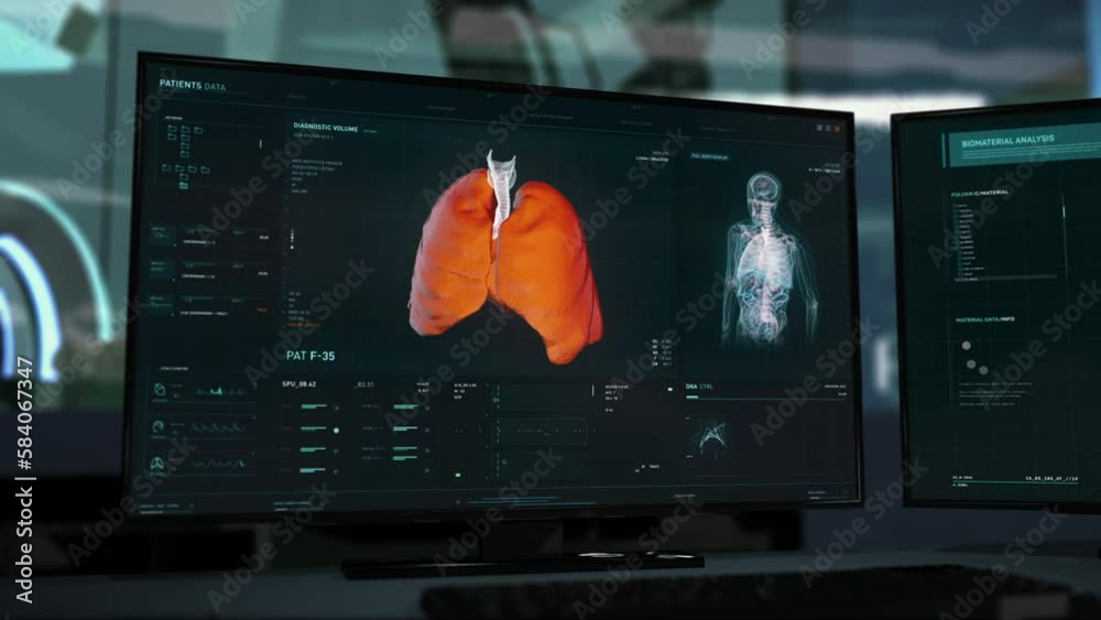 Innovative Software For Lung Disease Diagnosis Finds Cancer Cells ...
