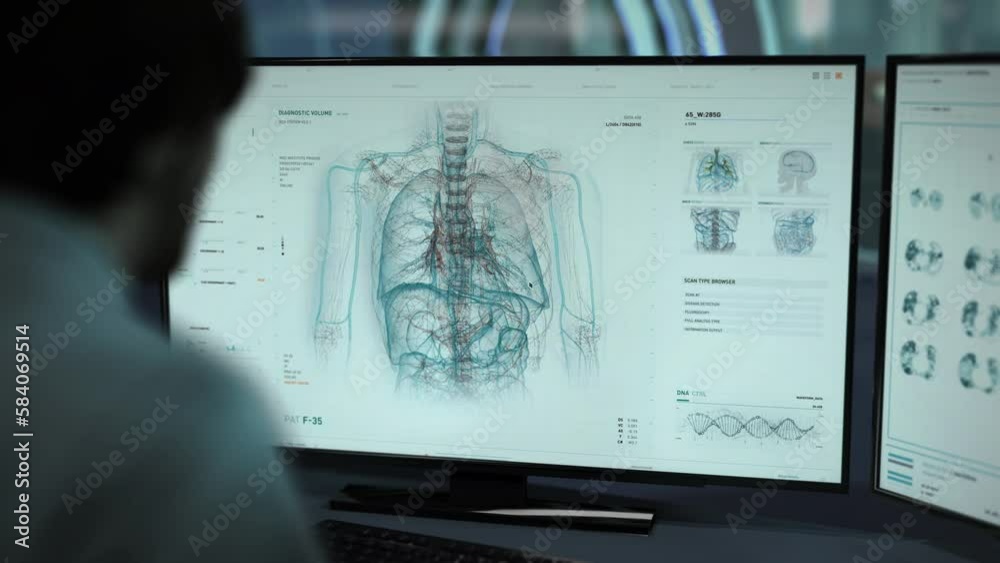 Vidéo Stock Doctor Monitors Cancer Tumor Using High Tech Molecular ...