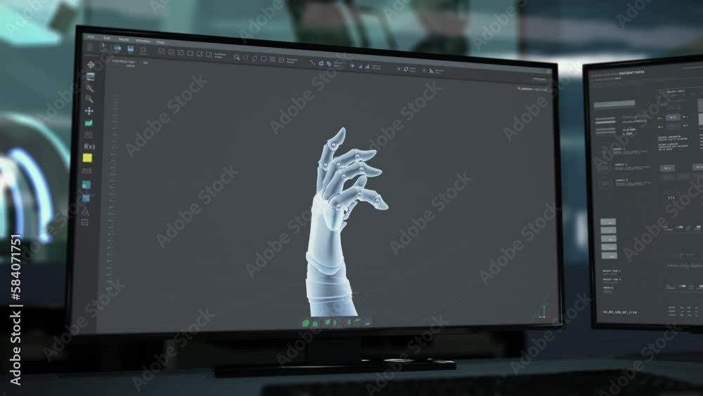 Innovative manufacturing software used for creation of prosthetic limbs ... Innovative manufacturing software used for creation of prosthetic limbs ...