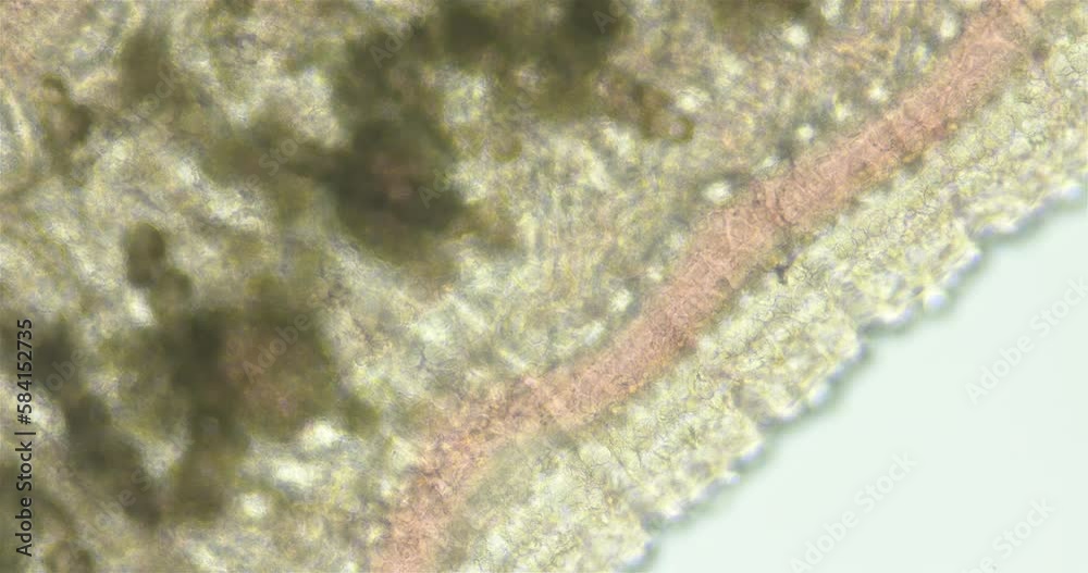 Leech family Erpobdellidae under a microscope, order Arhynchobdellida. Possibly genus Erpobdella ...