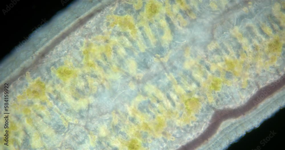 Leech family Erpobdellidae under a microscope, order Arhynchobdellida ...