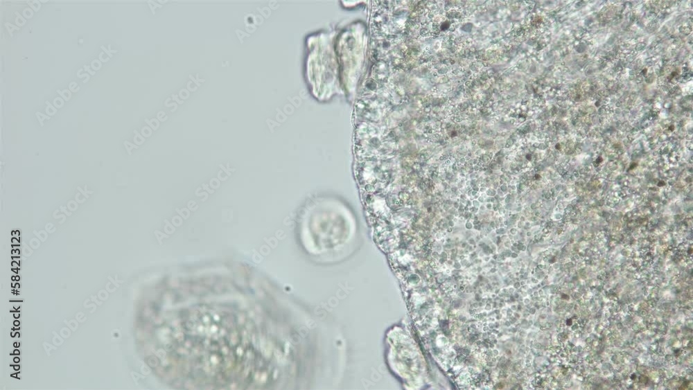 Infusoria Ciliophora Kerona polyporum and Trichodina under microscope ...