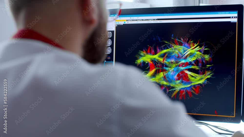 Medical hospital: neurologist use computer, analyze patient's MRI ...