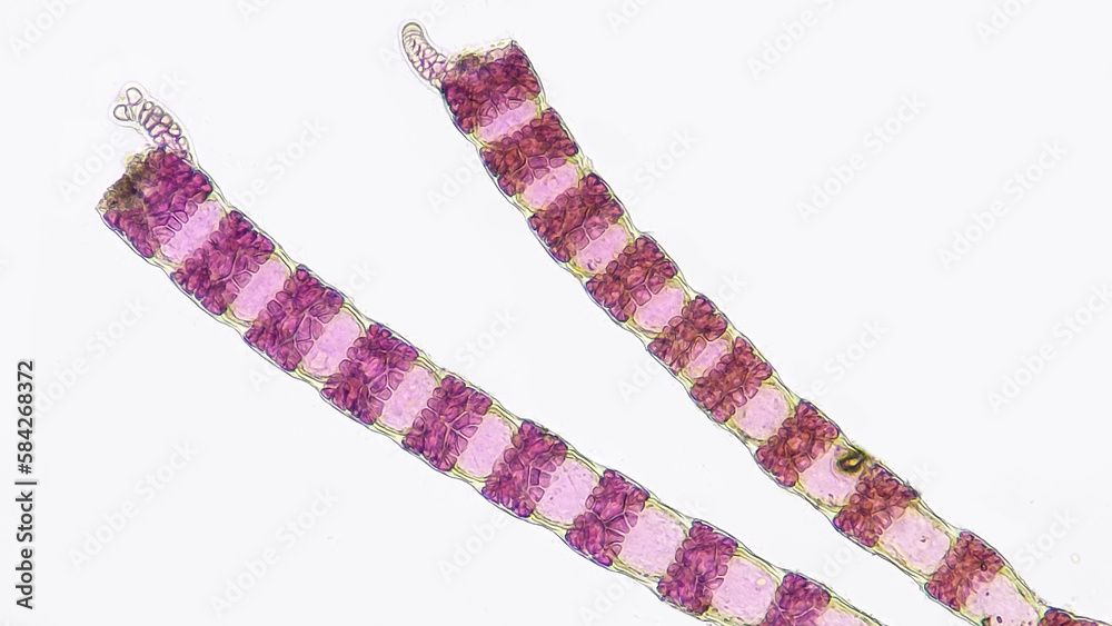 Marine seaweed, Ceramium sp. under microscope. 10x objective lens ...